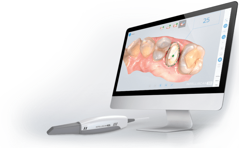 Introducing Digital Dentistry to Your Practice Via Intraoral Scanning ...