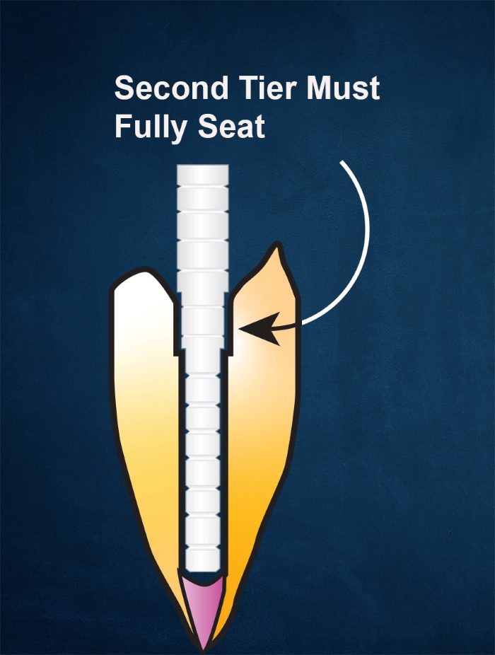 Factors for Successful Endodontic Post Placement: A Step-By-Step Guide ...