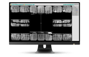 DEXIS Imaging Suite Software - Group Dentistry Now